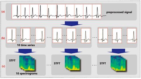 A Deep Learning Approach For Mental Fatigue State Assessment