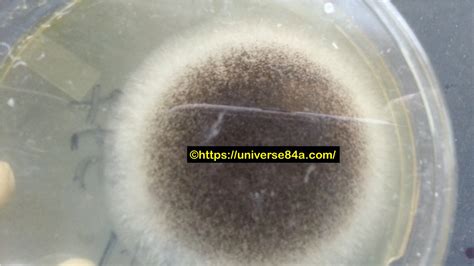 Aspergillus Niger Introduction Morphology Pathogenicity Lab Diagnosis