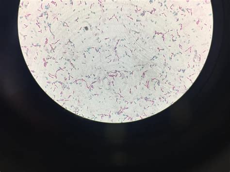 Old Bacillus Cereus Endospore Stain Microbiology