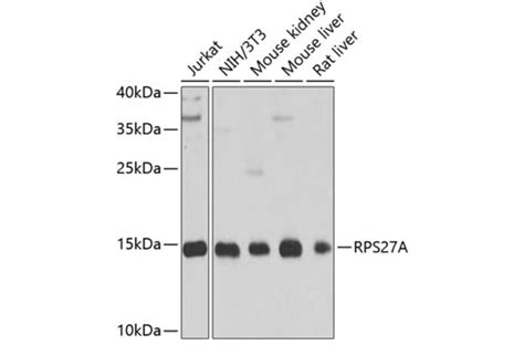 Anti Ubiquitin Antibody A13820