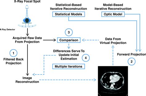 Iterative Reconstruction Techniques In Abdominopelvic Ct Technical
