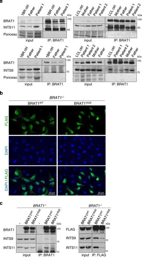 Brat1 Links Integrator And Defective Rna Processing With Neurodegeneration Pmc