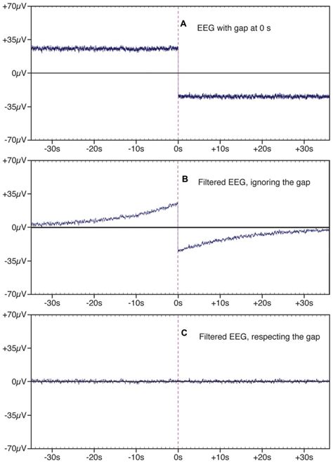 Example Of A Segment Of EEG Data In Which There Is A Gap Of A Few Download Scientific Diagram