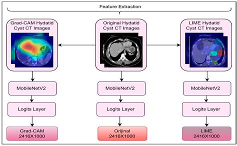 Image Visualization And Classification Using Hydatid Cyst Images With An Explainable Hybrid Model