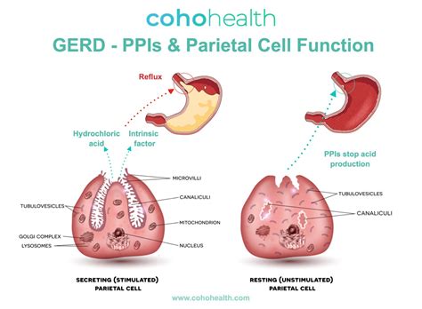 The Functional Medicine Approach To Gerd Feel Better Faster