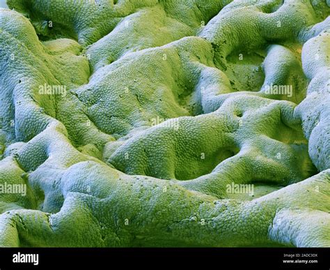 Gallbladder Lining Coloured Scanning Electron Micrograph Sem Of The Internal Lining Of The