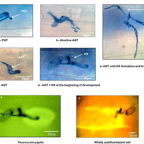 A Microscopic Observations Of Different Stages Of Blumeria Graminis F