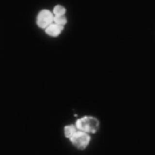 CANCA Figure PANCA Download Scientific Diagram