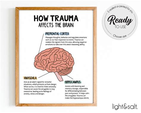 How Trauma Affects The Brain Human Brain Poster Brain Etsy
