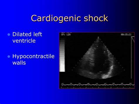 Ppt Cardiac Ultrasound In Emergency Medicine Powerpoint Presentation