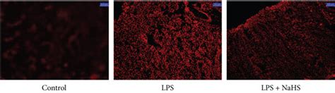 exogenous h2s attenuated inflammatory cytokine and oxidative stress in
