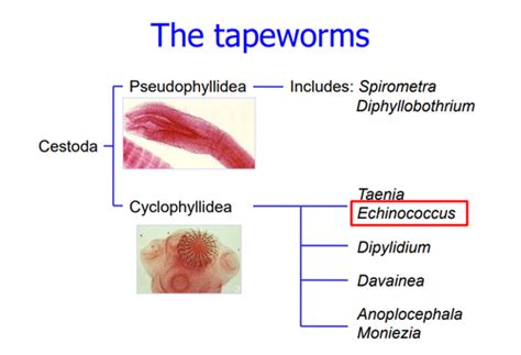 5 Hydatid Disease And Echinococcus Flashcards Quizlet