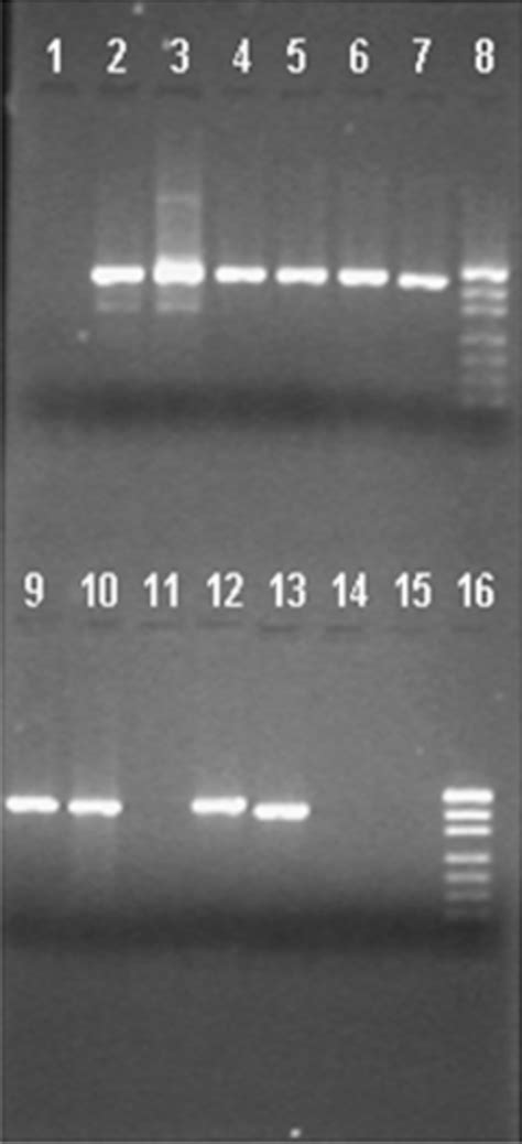 Results Of Representative Nested Pcr Amplification Shown Is A Gel Of