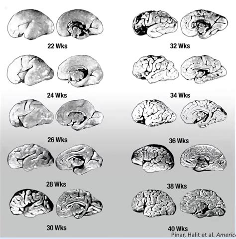 Fetal Autopsy Determining Gestational Age The Autopsy Book