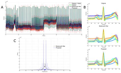 Powerline Noise Elimination In Biomedical Signals Via Blind Source Separation And Wavelet
