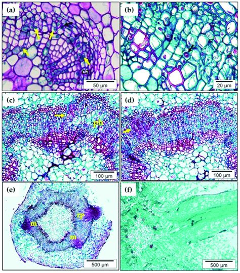 Histological Analysis During The Adventitious Root Formation In Download Scientific Diagram