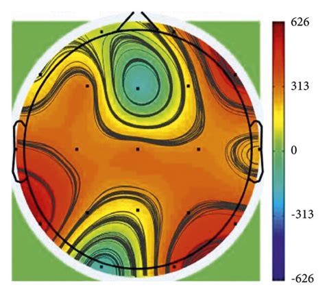 A Sample Of The Extracted Topo Map Download Scientific Diagram