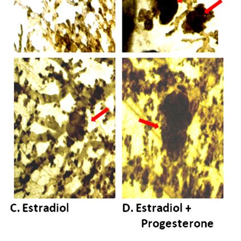A D Effect Of Long Term Estradiol Or Progesterone Or Combination Of