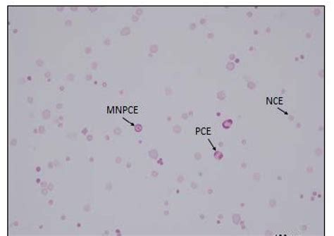 Normal Polychromatic Pce And Normochromatic Nce Erythrocytes And