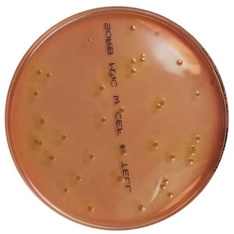 Sorbitol Macconkey Agar With Cefixime And Tellurite Pk 10 Trafalgar