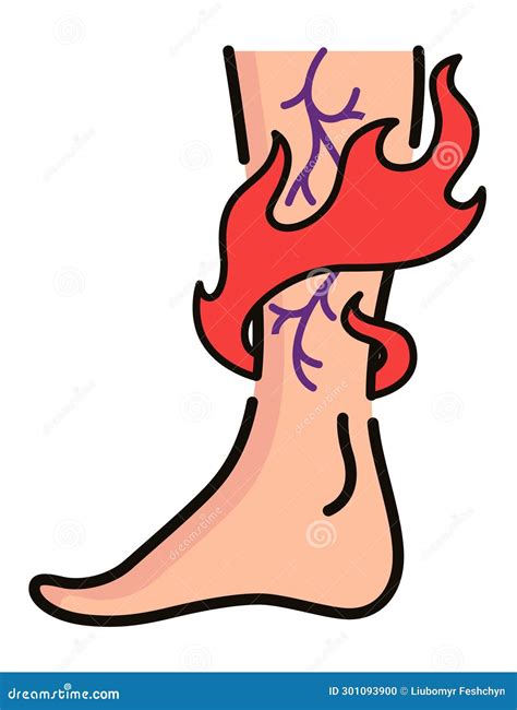 Varicose Treatment Icon Violation Of Circulatory System Vascular