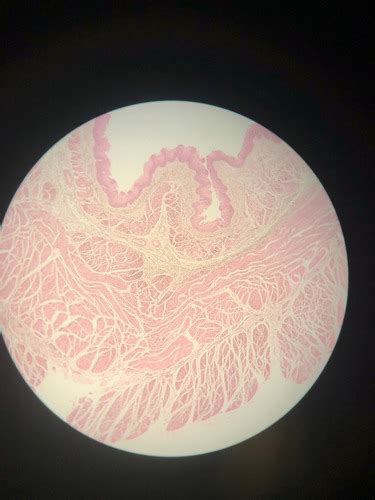 Microscope Slides Exam 3 Lab Flashcards Quizlet