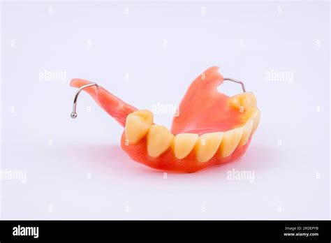 Removable Denture Of An Upper Jaw Denture Dental Prosthesis Dentist