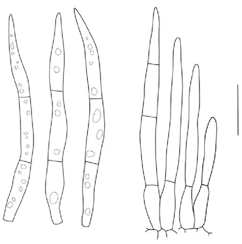 Conidia And Conidiogenous Cells Of Phloeosporella Ceanothi Redrawn Download Scientific Diagram