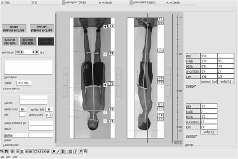 The Photograph Entered Into A Body Posture Assessing Software Posture Download Scientific