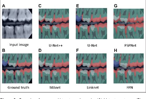 figure 2 from benchmarking deep learning models for tooth structure