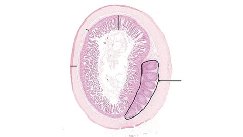 Defense Barriers Low Power Histology Slides Flashcards Quizlet