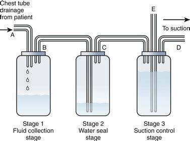 Autotransfusion Clinical Gate