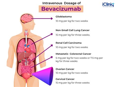 What Is Bevacizumab