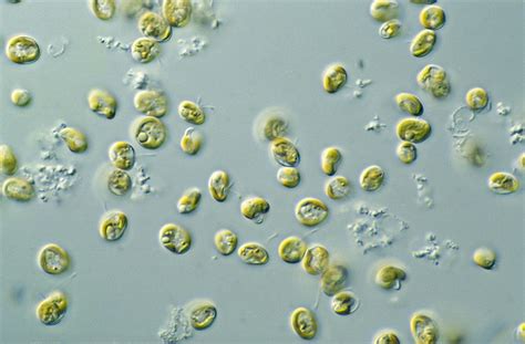Difference Between Algae And Microalgae Definition Types Features