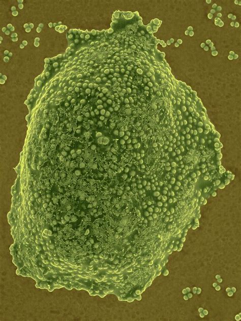 Staphylococcus Aureus Colony Mrsa Strain Photograph By Dennis Kunkel
