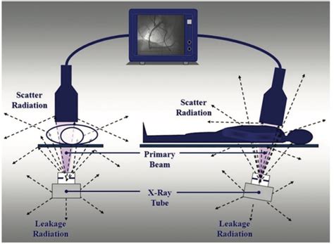 Novel Radiation Protection Devices An Update On Radiation Safety In