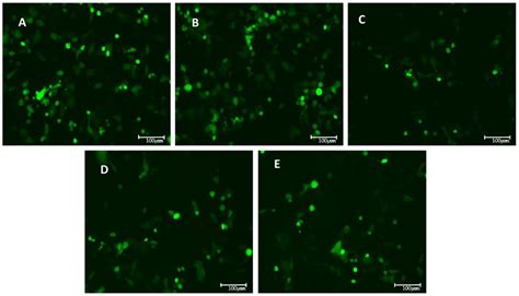 Influence Of Sex And 125α Dihydroxyvitamin D3 On Sars Cov 2 Infection