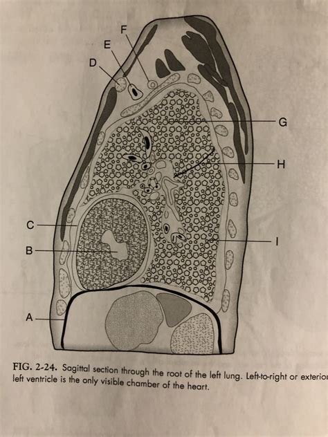 Labeling Part 24 Diagram Quizlet