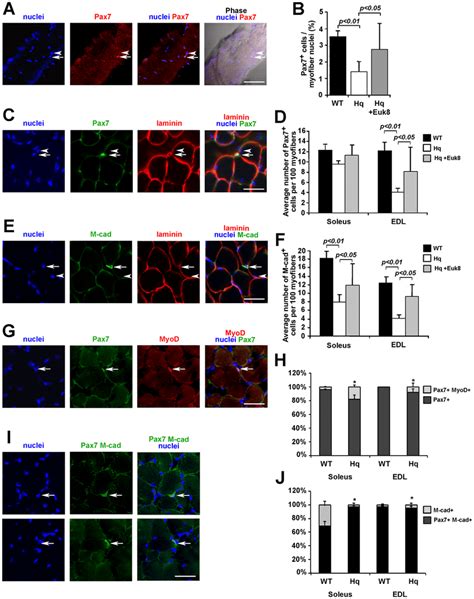Loss Of Satellite Cells In Aif Deficient Mice A Representative