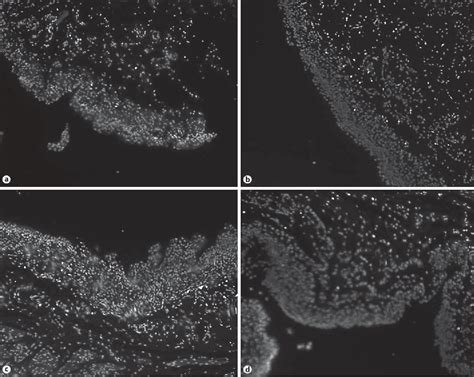 Rat Urinary Bladder Semantic Scholar
