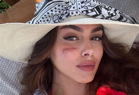 Klea Prenga Publikon Fotografi Të Reja Në Instagram Plaga Ende E