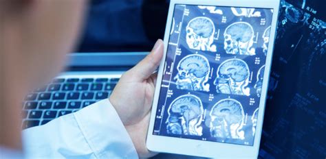 The Ultimate Radiology Quiz Trivia Quiz Flashcards Trivia