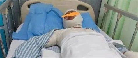 6名初三学生实验课上被烧伤！紧急提示→ 操作 酒精 发生爆炸