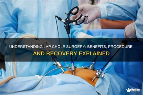 Understanding Lap Chole Surgery Benefits Procedure And Recovery Explained Medshun