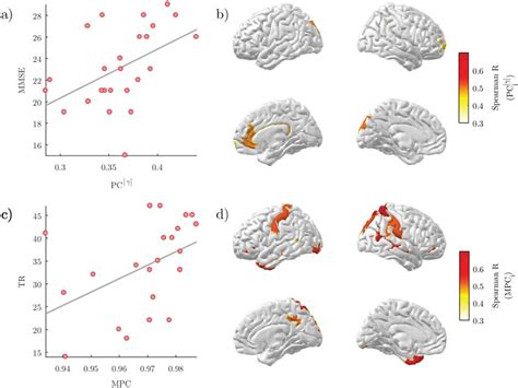Correlation Between Brain Network Properties And Cognitivememory Download Scientific Diagram