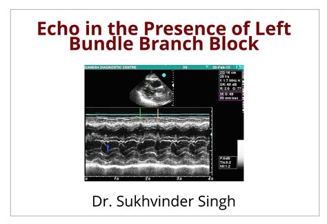 Echocardiography In The Presence Of Left Bundle Branch Block Cardioserv