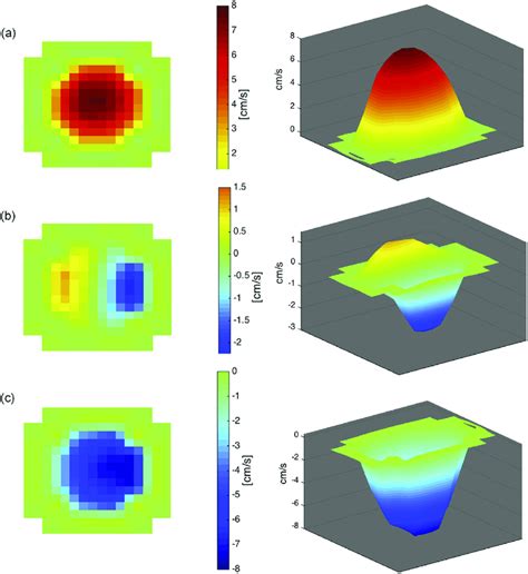 Bidirectional CSF Flow In Cerebral Aqueduct Of An INPH Patient IDs Download Scientific Diagram