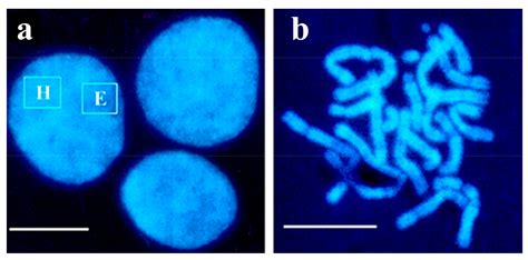 Macromolecular Structure Of Linearly Arranged Eukaryotic Chromosomes