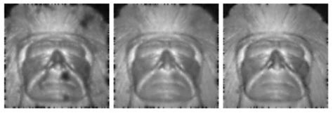 Estimated Depth Map For Synthetic Case A Focused Image B Download Scientific Diagram