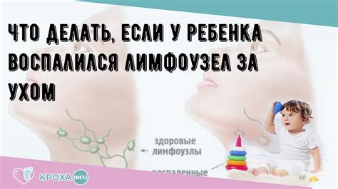 Что делать если у ребенка воспалился лимфоузел за ухом Youtube